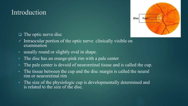 Optic Disc Abnormalities and their presentations | PPTX | Pregnancy ...