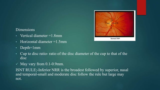 Optic Disc Abnormalities and their presentations | PPTX | Pregnancy ...
