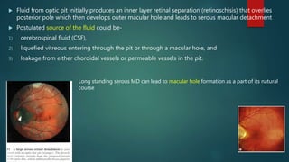 CONGENITAL OPTIC DISC ANOMALIES | PPTX