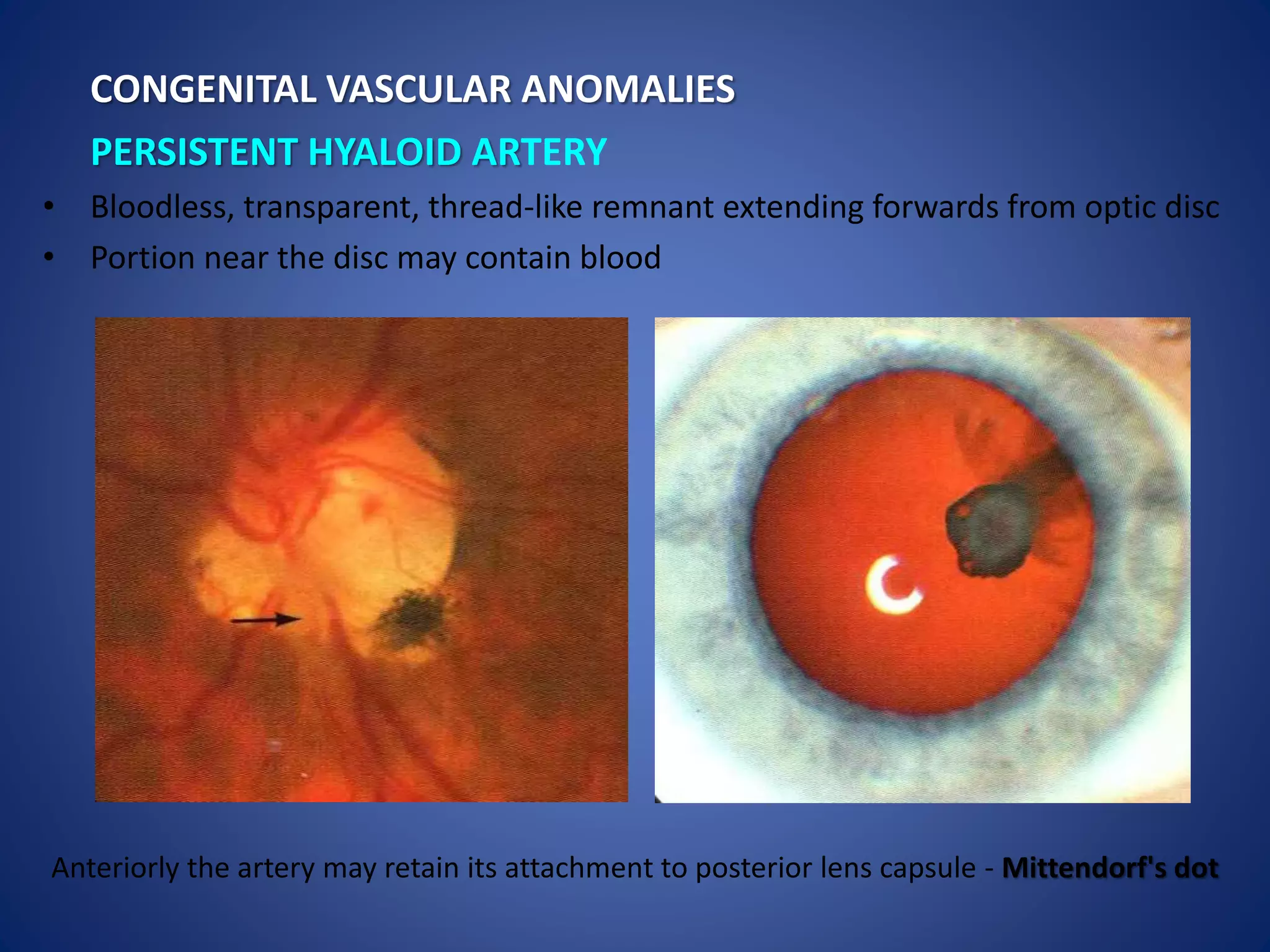 Optic disc evaluation | PPTX