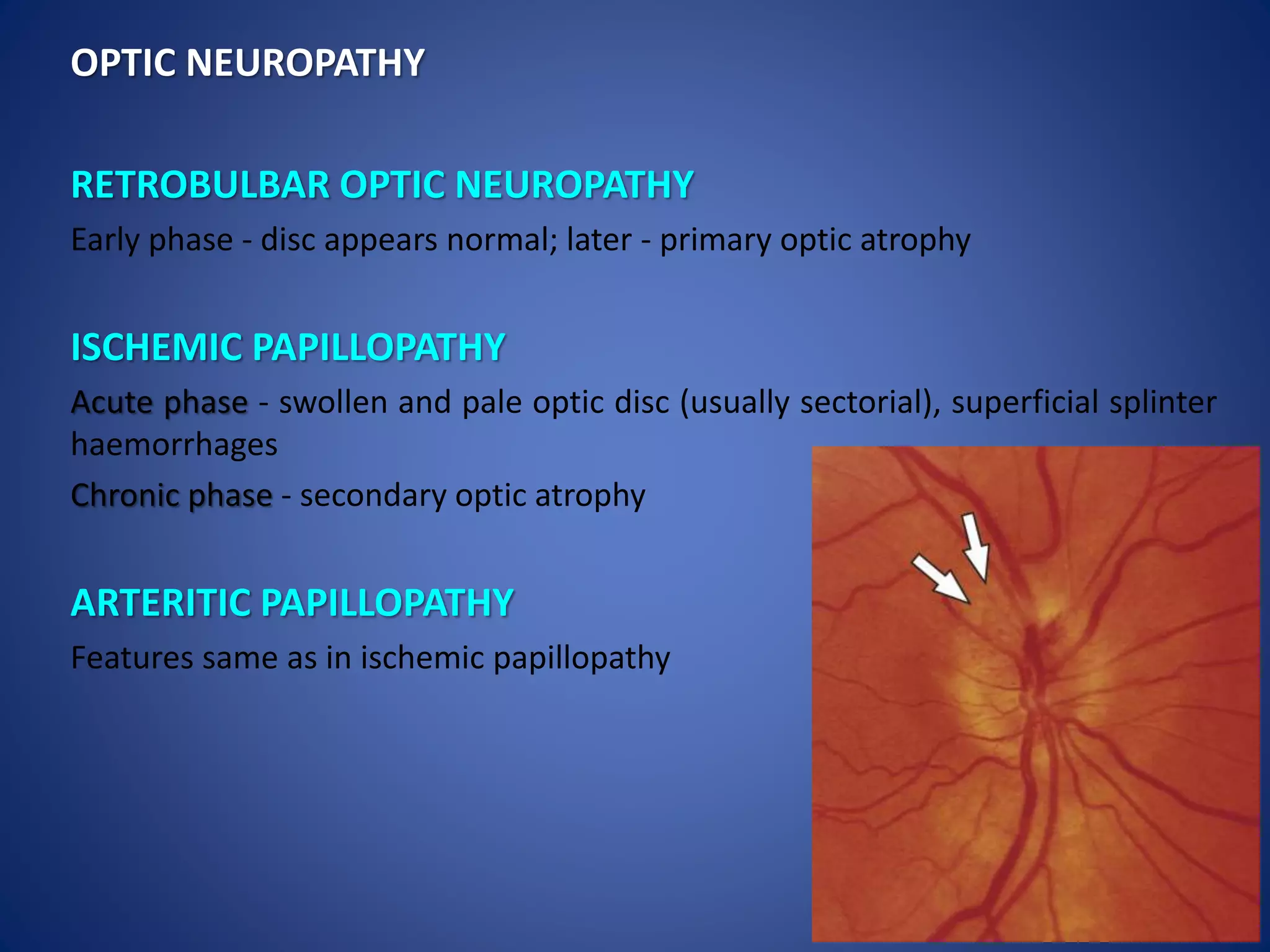Optic disc evaluation | PPTX
