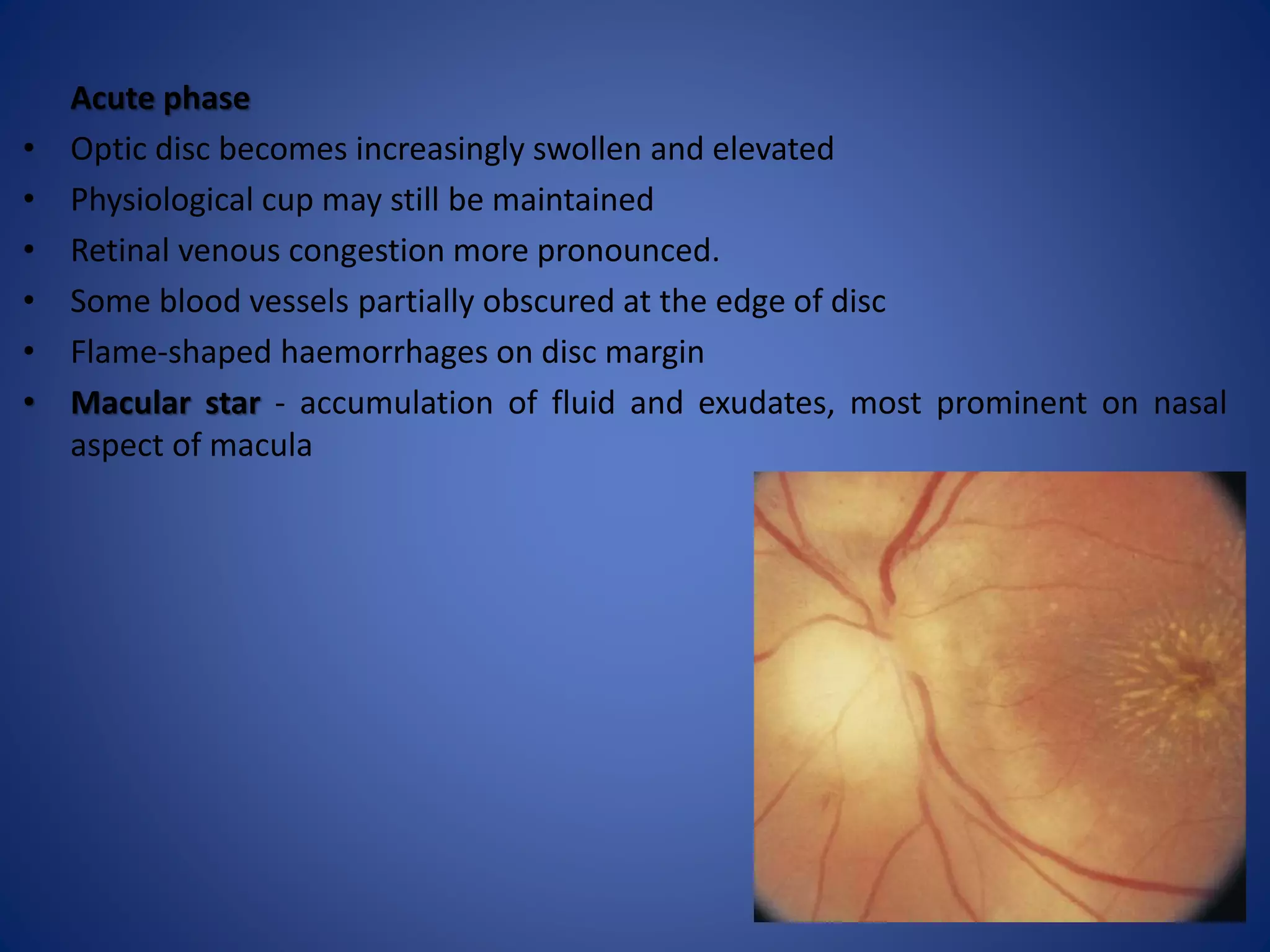 Optic disc evaluation | PPTX