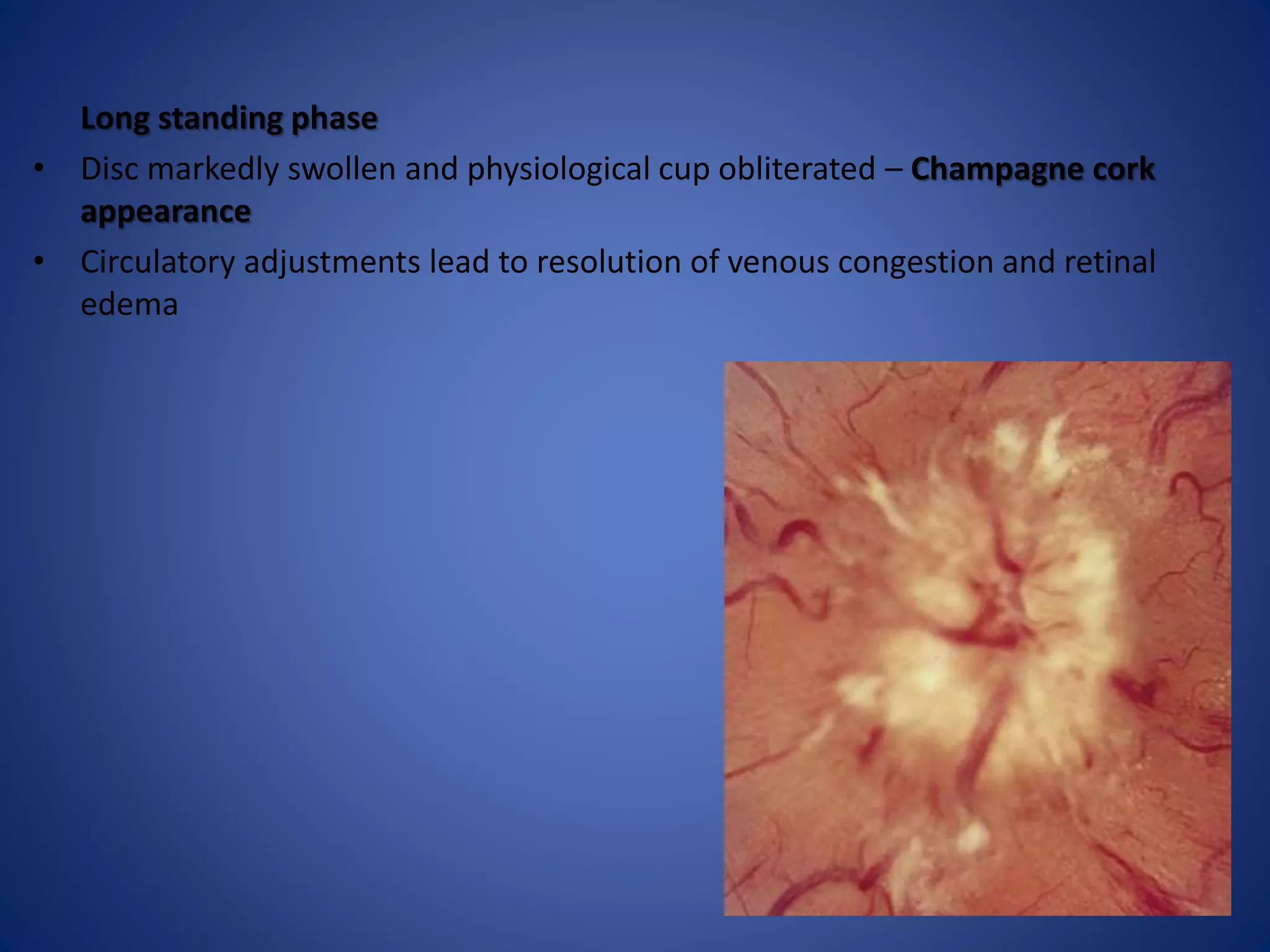 Optic disc evaluation | PPTX
