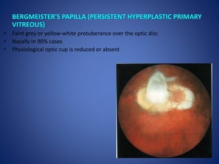 Optic disc evaluation | PPTX