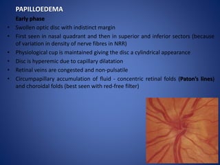 Optic disc evaluation | PPTX
