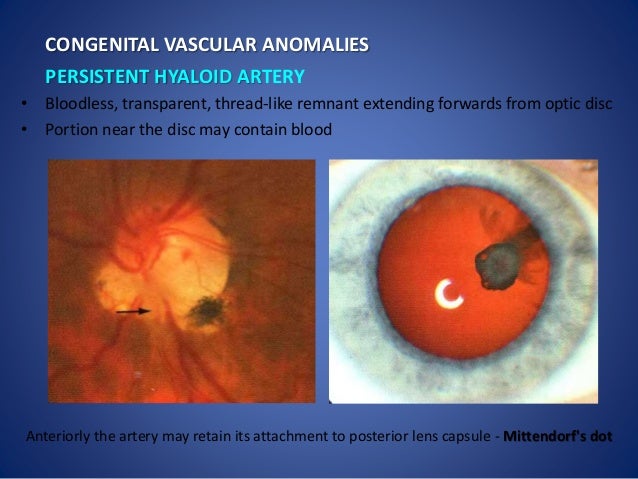 Optic disc evaluation