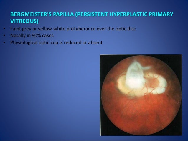 Optic disc evaluation