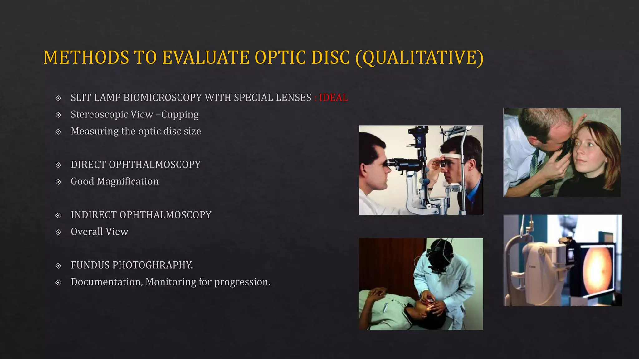 optic disc evaluation in glaucoma.pptx