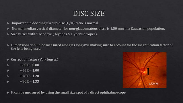 optic disc evaluation in glaucoma.pptx