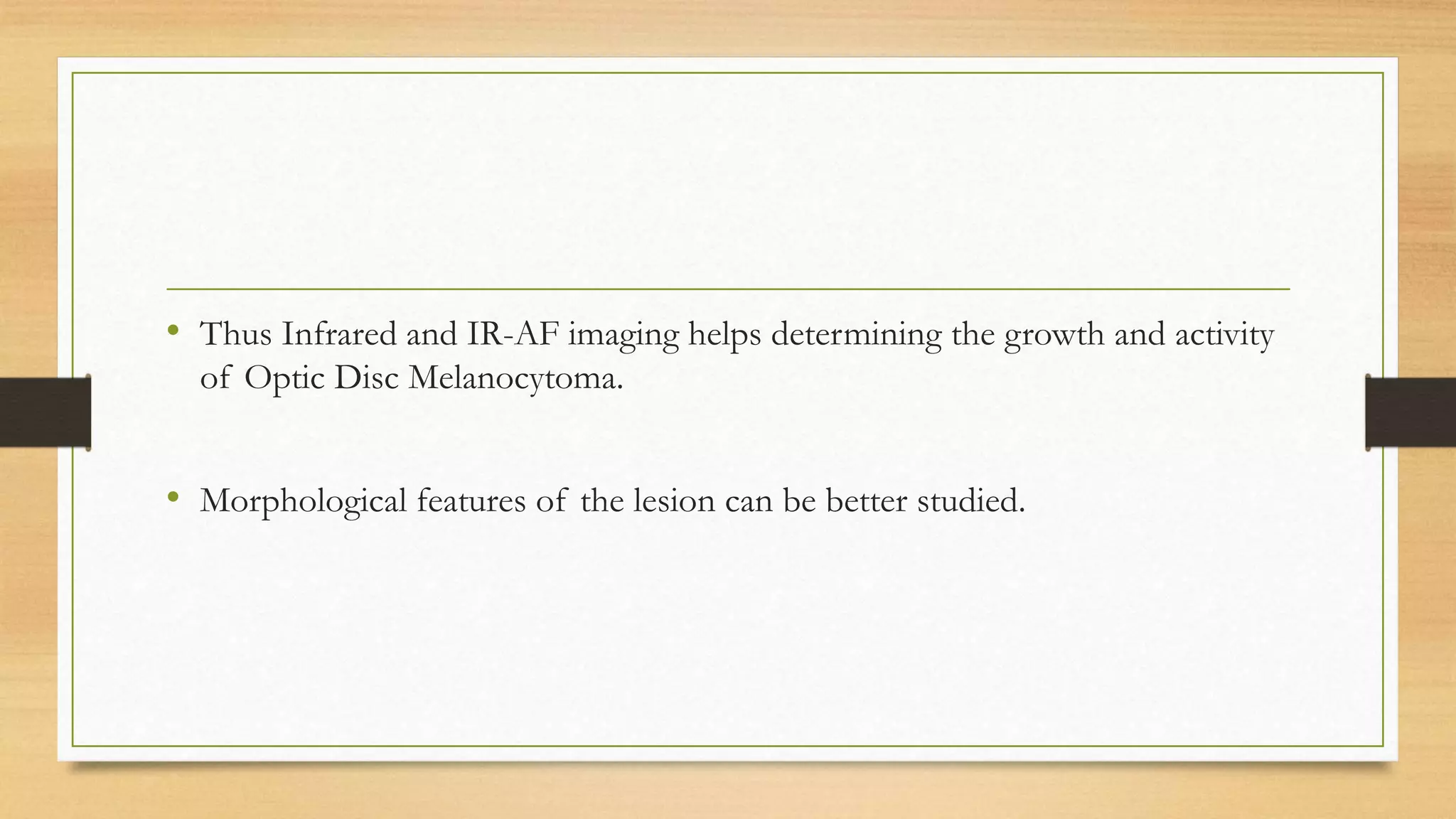 Optic disc melanocytoma | PPTX