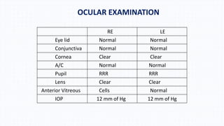 Optic disc melanocytoma | PPT