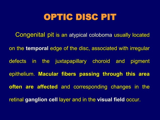 OPTIC DISC PIT Pathogenesis and Management | PPT | Eye and Vision ...