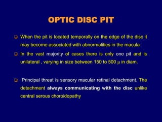 OPTIC DISC PIT Pathogenesis and Management | PPT