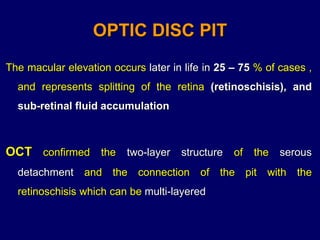 OPTIC DISC PIT Pathogenesis and Management | PPT
