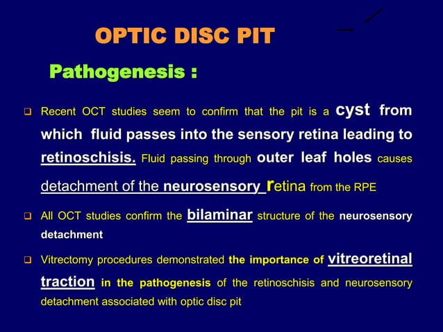 OPTIC DISC PIT Pathogenesis and Management | PPT | Eye and Vision ...