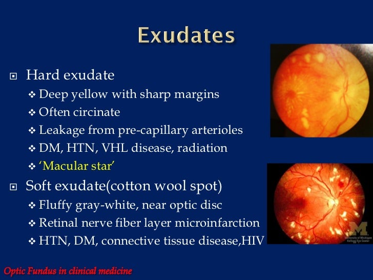 Optic fundus in clinical medicine