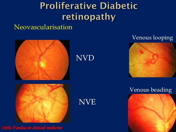 Optic fundus in clinical medicine