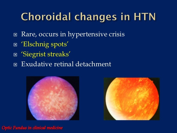 Optic fundus in clinical medicine