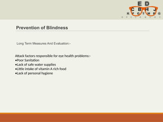 Optician-Vision-Of-Eyesight-Vector-PowerPoint-Templates-Standard.pptx