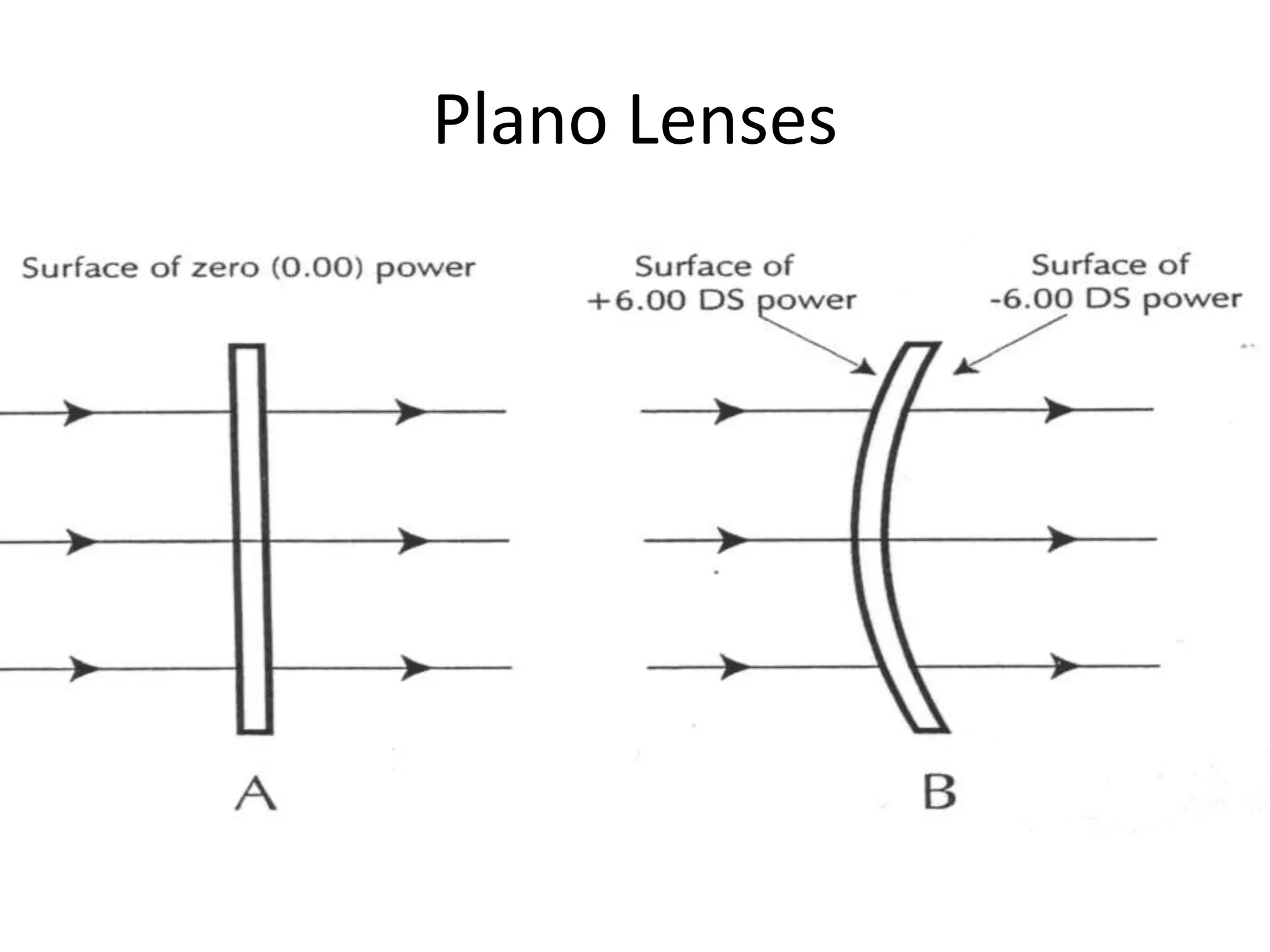 Optic Lens And Iol Pptx