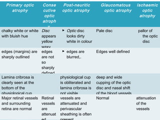 Optic nerve | PPT
