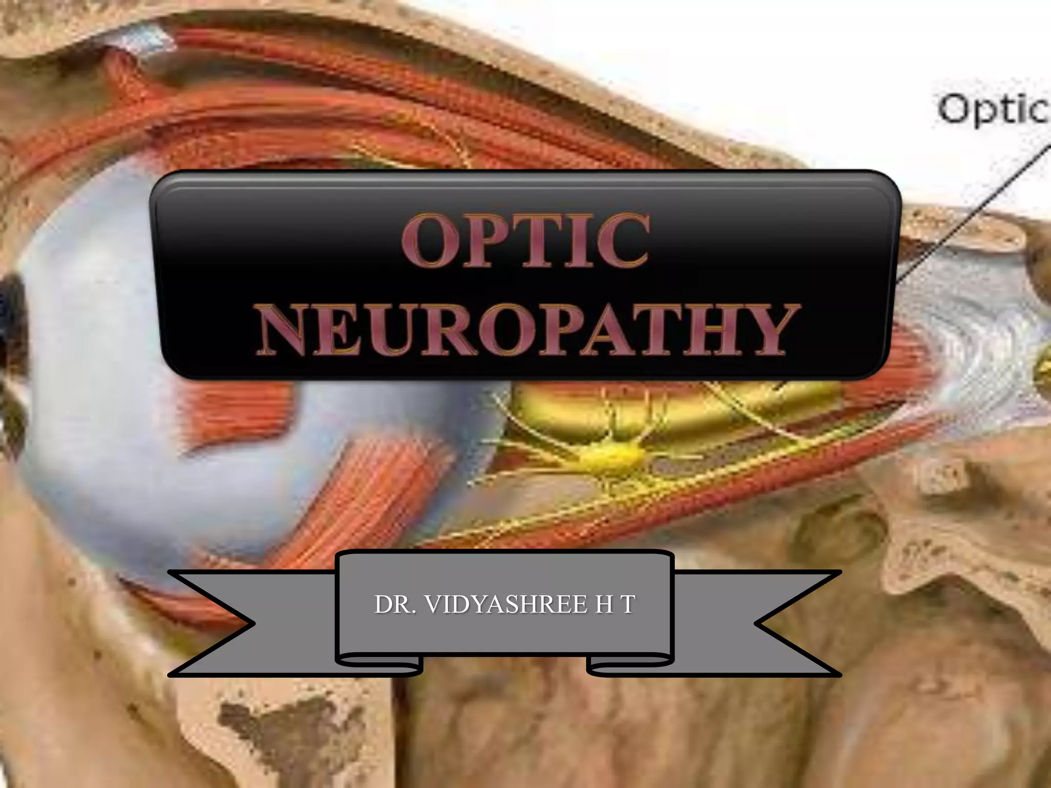 Optic nerve and its disorders | PPTX