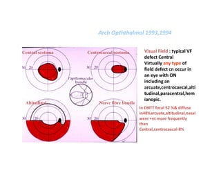 Optic nerve.pdf cranial nerve medical seminar | PDF