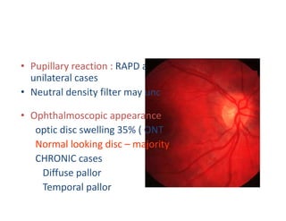 Optic nerve.pdf cranial nerve medical seminar | PDF