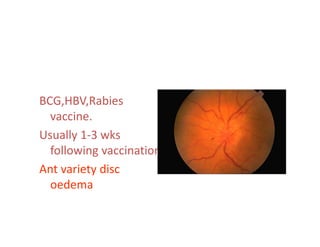 Optic nerve.pdf cranial nerve medical seminar | PDF