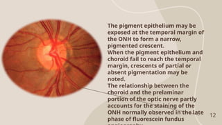 The embryology and anotomy of the optic nerve and its blood supply up ...