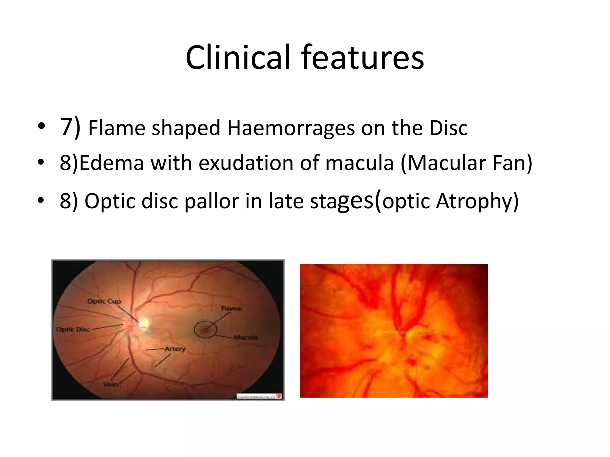 Optic nerve 1,dr.k.srikanth, 18.5.2016