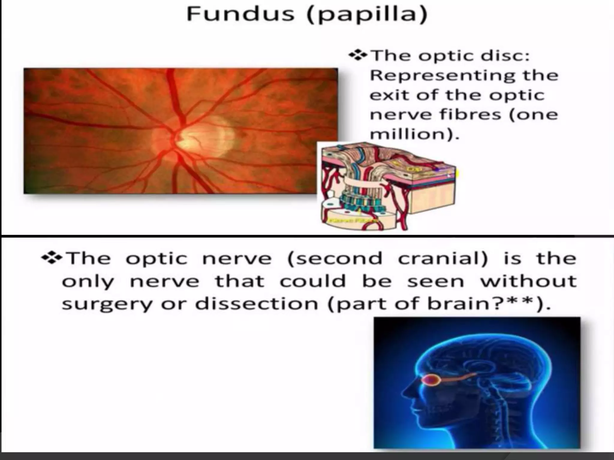 Optic Nerve: Clinical Examination – ZHERSS