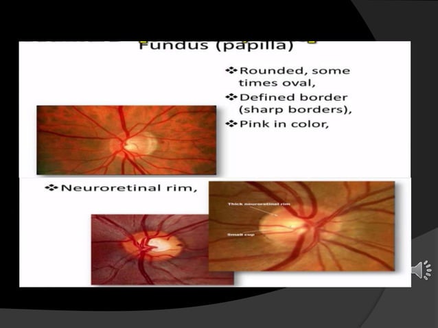 Optic nerve anatomy Clinical Round | PPTX