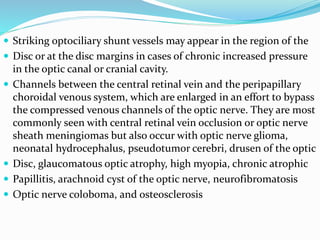 Optic Nerve Applied Anatomy, Clinical Evaluation and Approaches.pptx