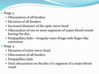 Optic Nerve Applied Anatomy, Clinical Evaluation and Approaches.pptx