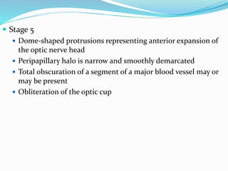 Optic Nerve Applied Anatomy, Clinical Evaluation and Approaches.pptx
