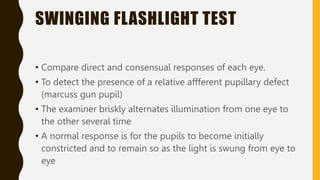 Optic nerve (cn ii) eXAMINATION and etc.pptx