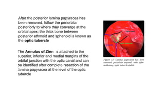 Optic nerve decompression with optic nerve.pdf