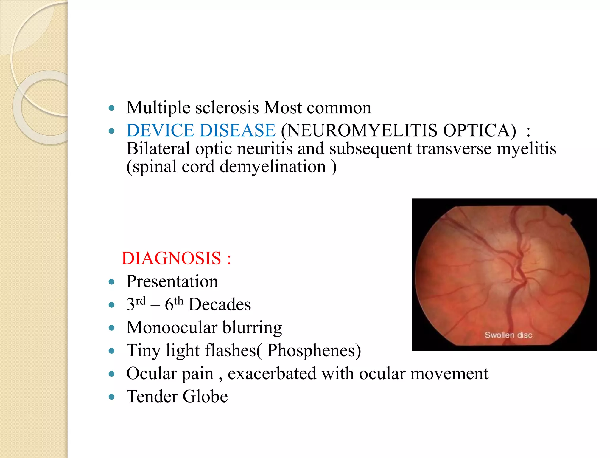OPTIC NERVE DISEASE | PPTX