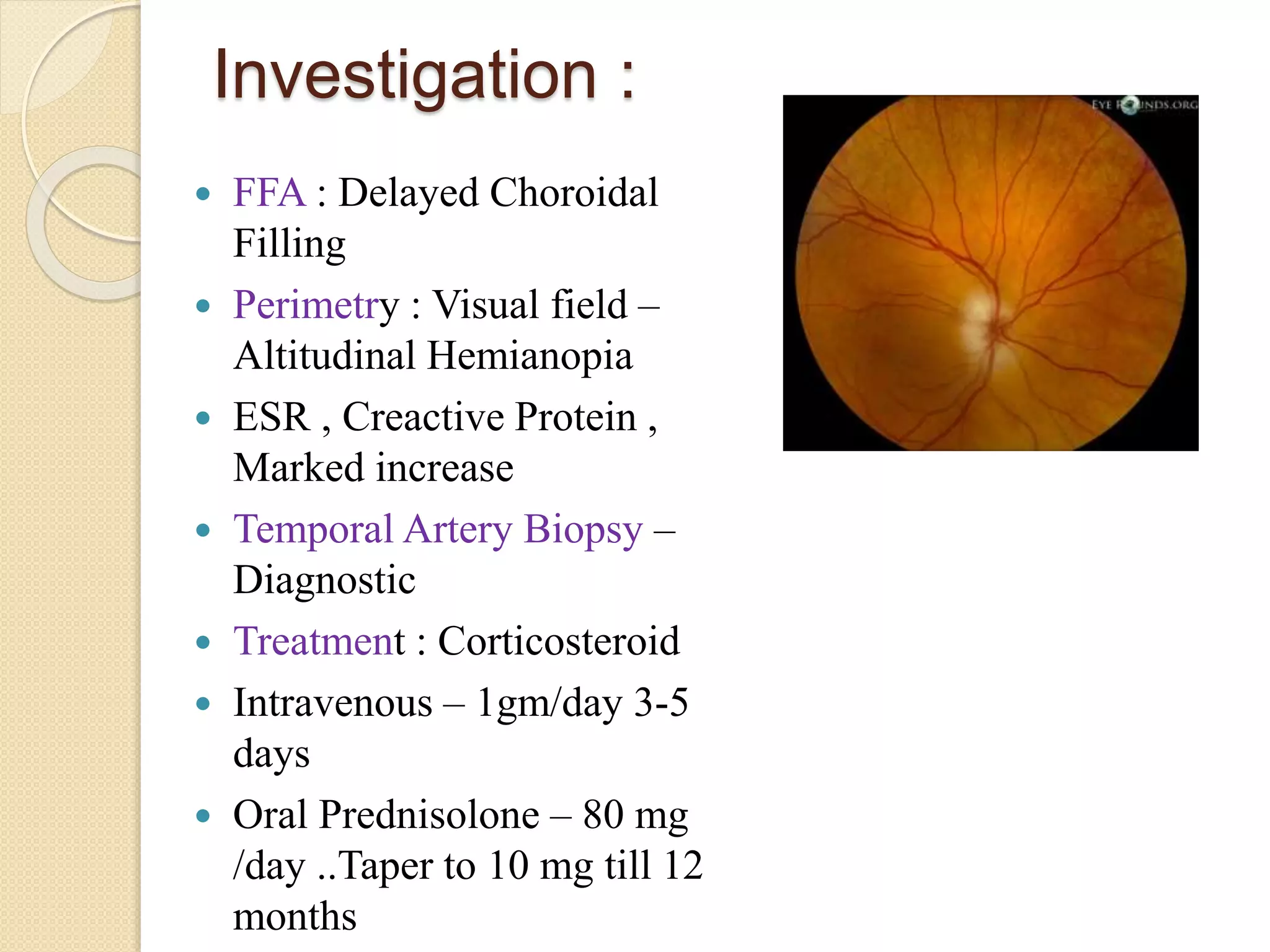 OPTIC NERVE DISEASE | PPTX