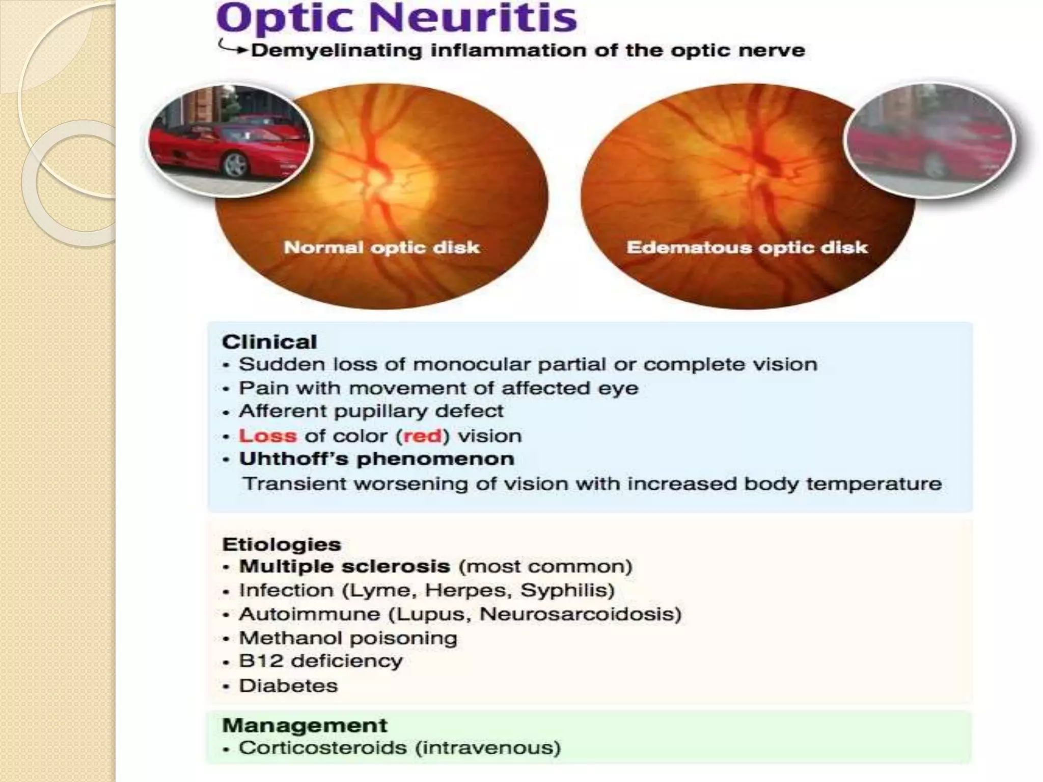 OPTIC NERVE DISEASE | PPTX