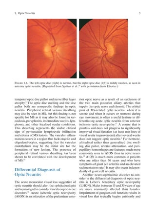 Optic Nerve Disorders Diagnosis and Management.pdf