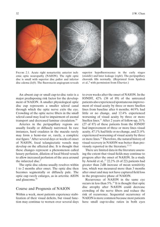 Optic Nerve Disorders Diagnosis and Management.pdf