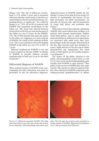 Optic Nerve Disorders Diagnosis and Management.pdf