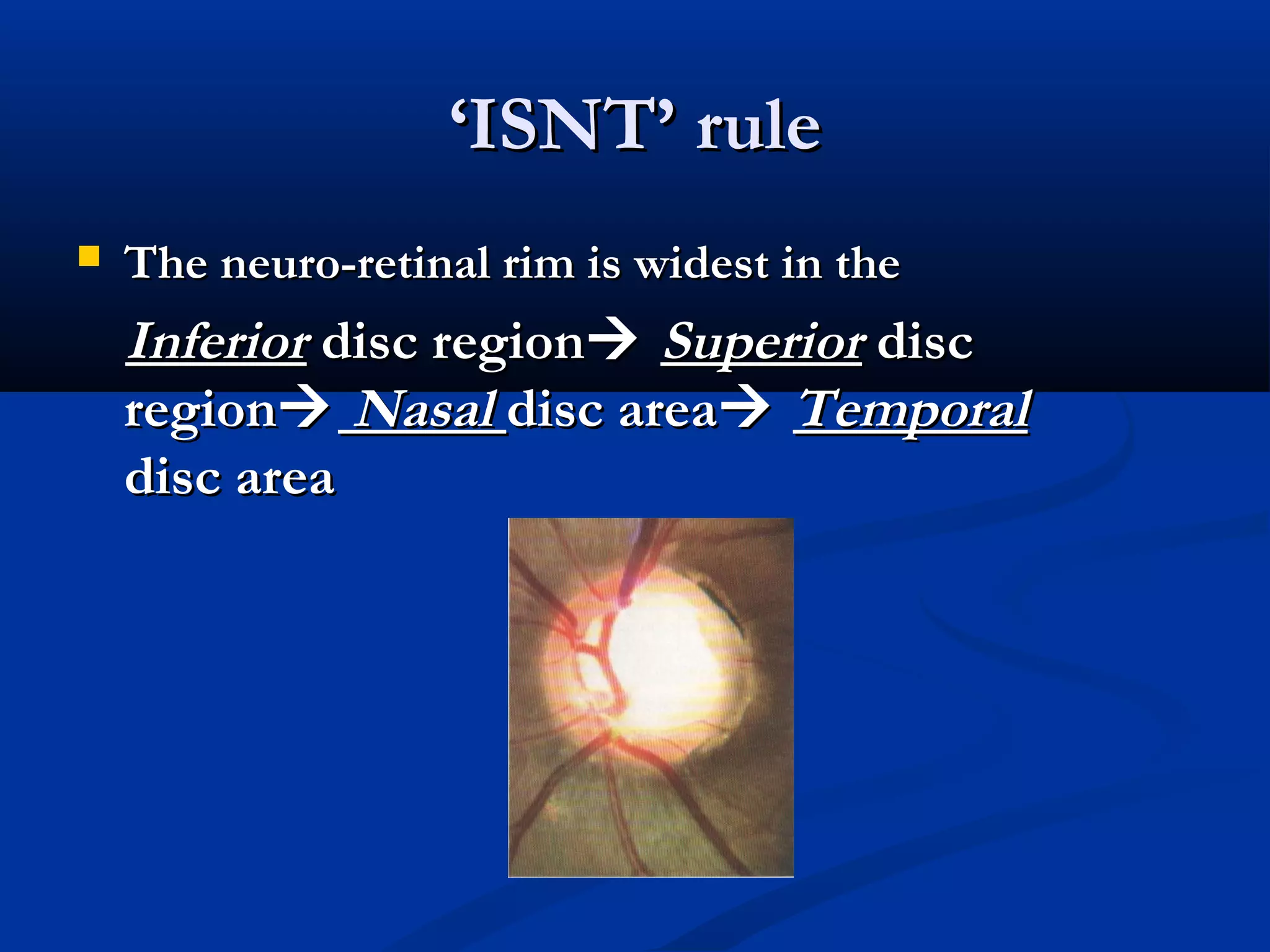 Optic nerve head evaluation | PPT