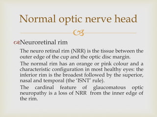 Optic nerve head evaluation in glaucoma | PPTX