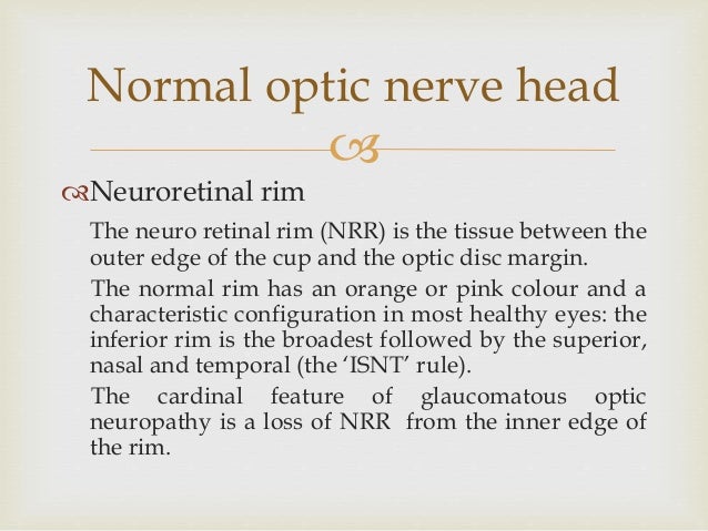 Optic nerve head evaluation in glaucoma