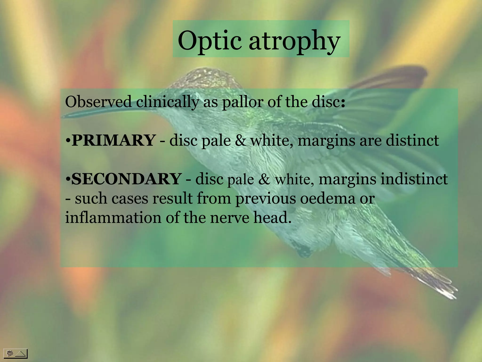 Optic nerve Diseases By: Sumayya Naseem Optometrist | PPS