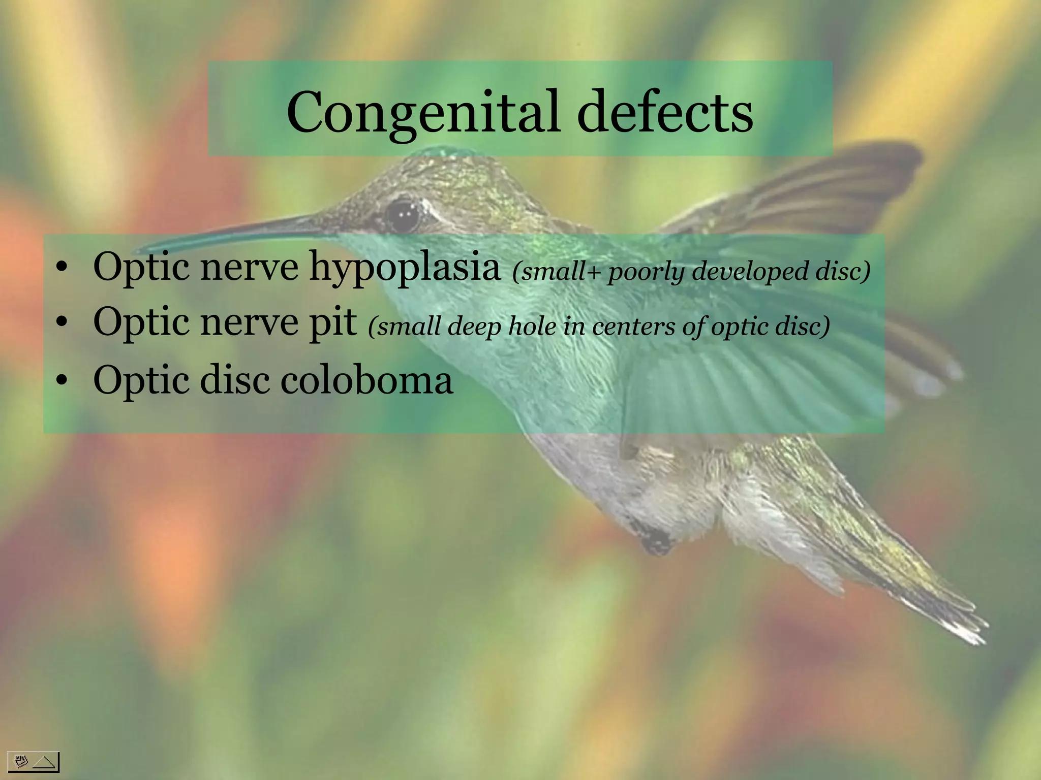 Optic nerve Diseases By: Sumayya Naseem Optometrist | PPS