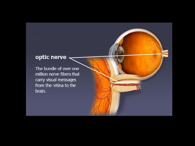 Optic nerve Diseases By: Sumayya Naseem Optometrist | PPS | Eye and ...